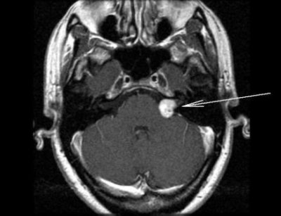 MRI • ImageCare Medical Imaging